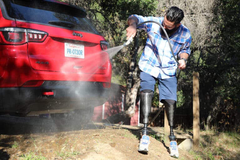 Amputation : définition, causes - Prothèse sur-mesure (jambe, tibiale ...